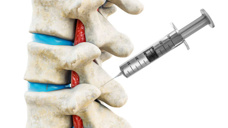 Facet Joint Injections - Barbour Orthopaedics & Spine